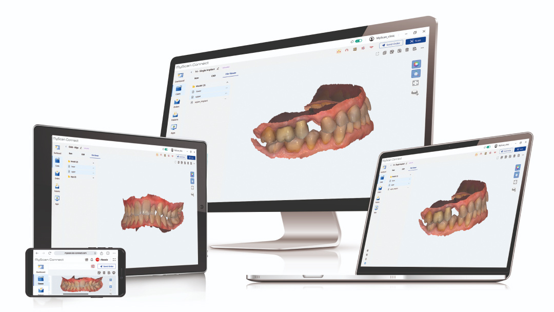 MyScan WR Wired Intraoral Scanner | MyRay
